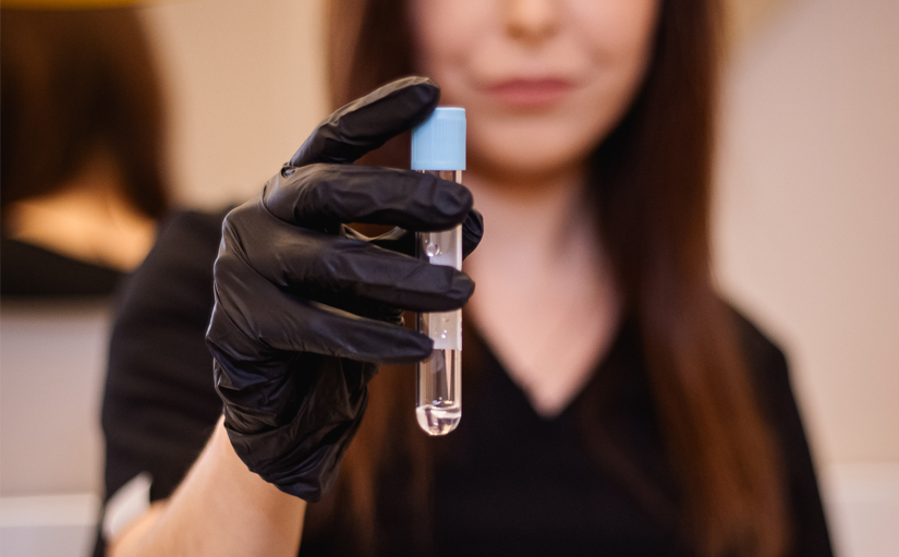 Angel system PRP - Klinika Dr Turowski